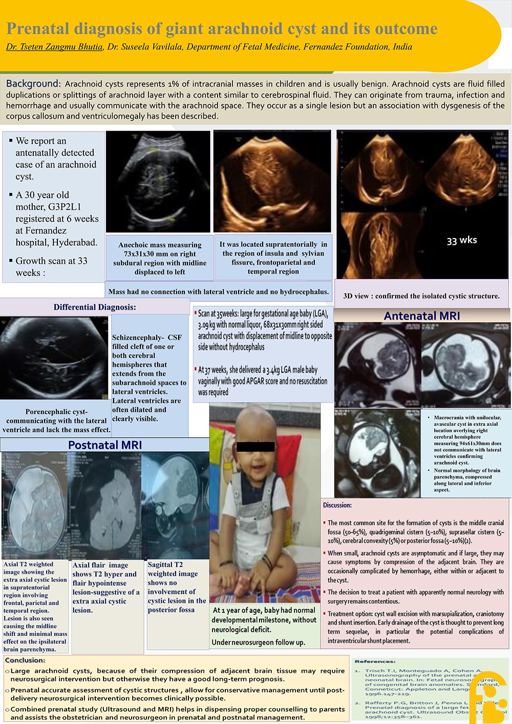 FMFI Fetal Neuroimaging Conference | Fetal Medicine Foundation – India